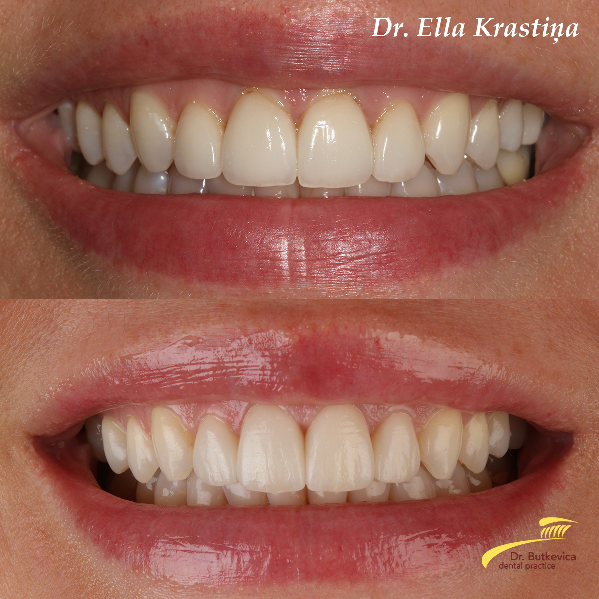 Laba zobārstniecība Rīgā ikvienam | Butkevicadental.com