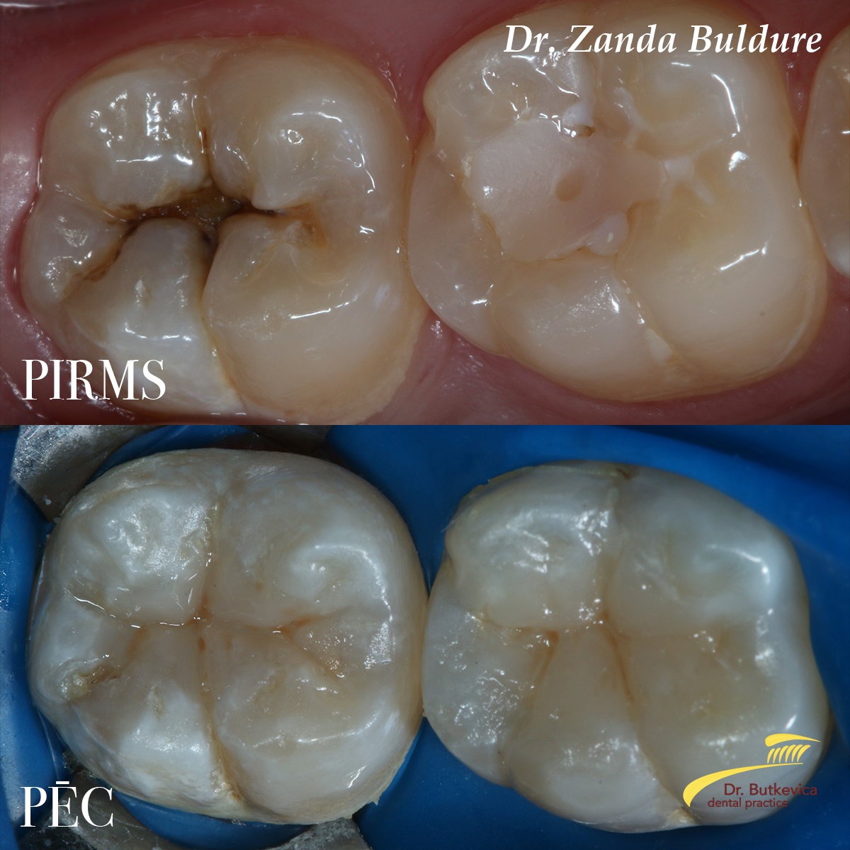 Laba zobārstniecība Rīgā ikvienam | Butkevicadental.com